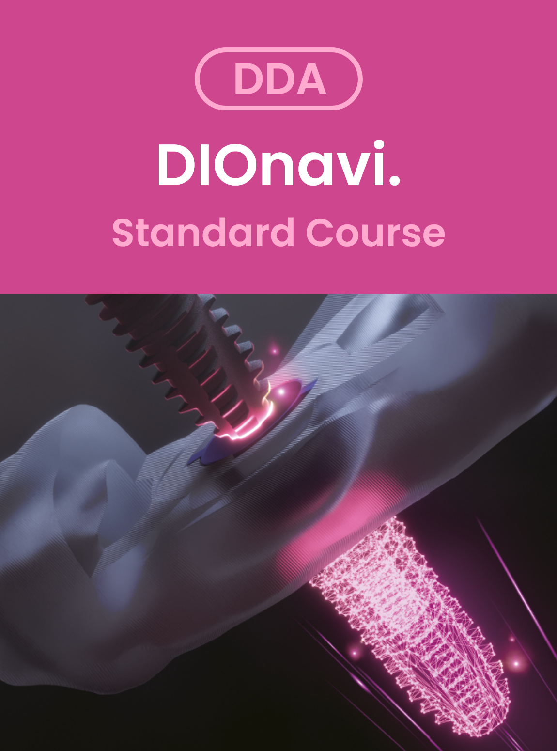 DIO IMPLANT | DIO Implant Academy